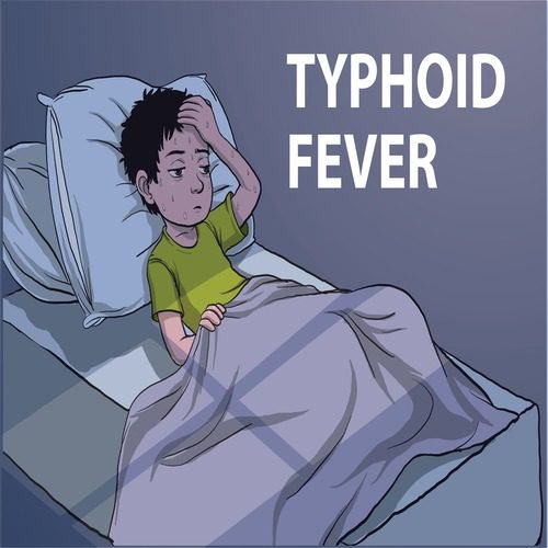 Typhoid Fever